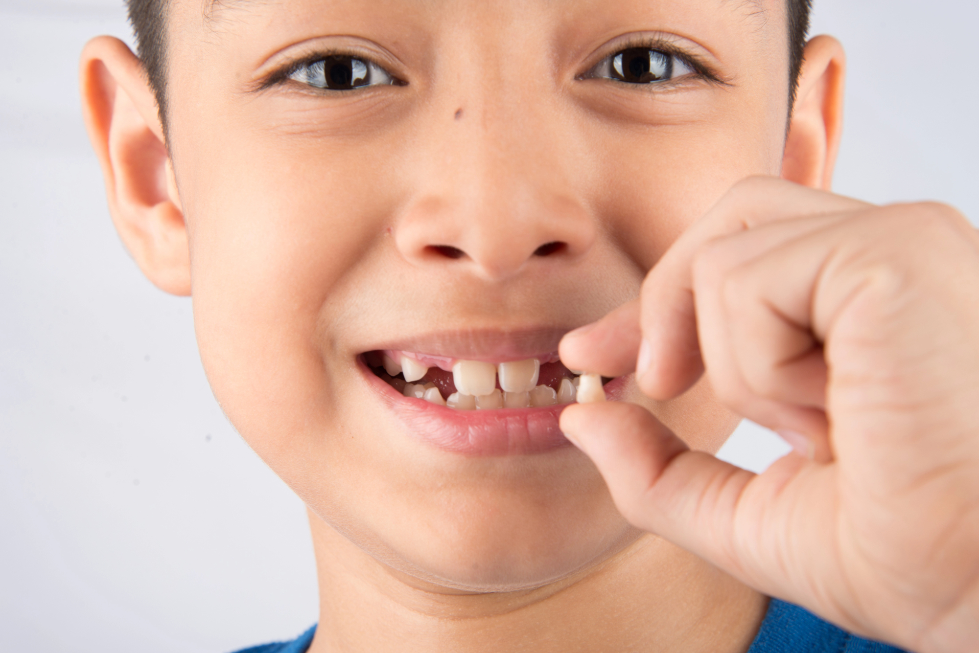Child Tooth Extraction – Toronto Kids Dental